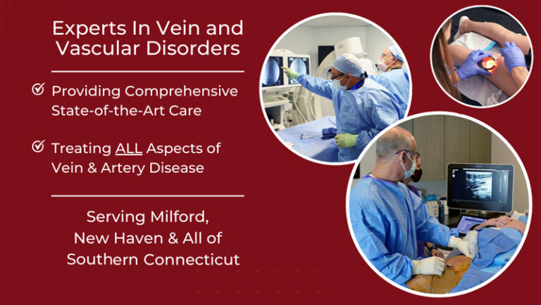 Vascular Surgeon New Haven County CT- Milford Vascular Institute